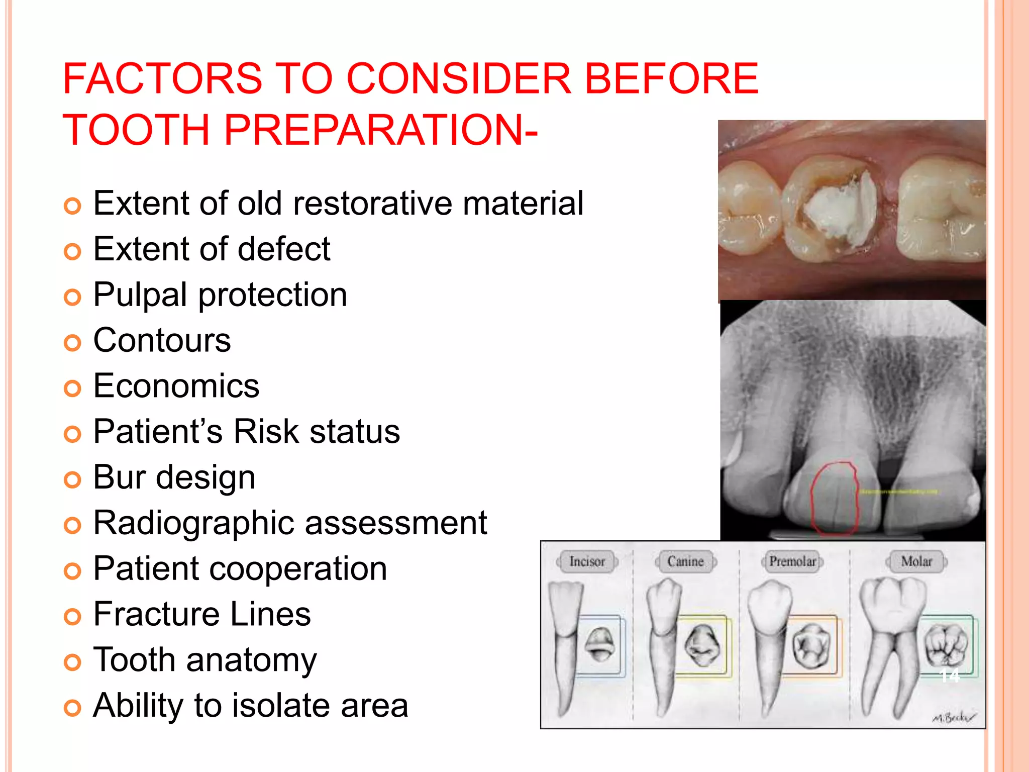 Class i cavity preparation | PPTX