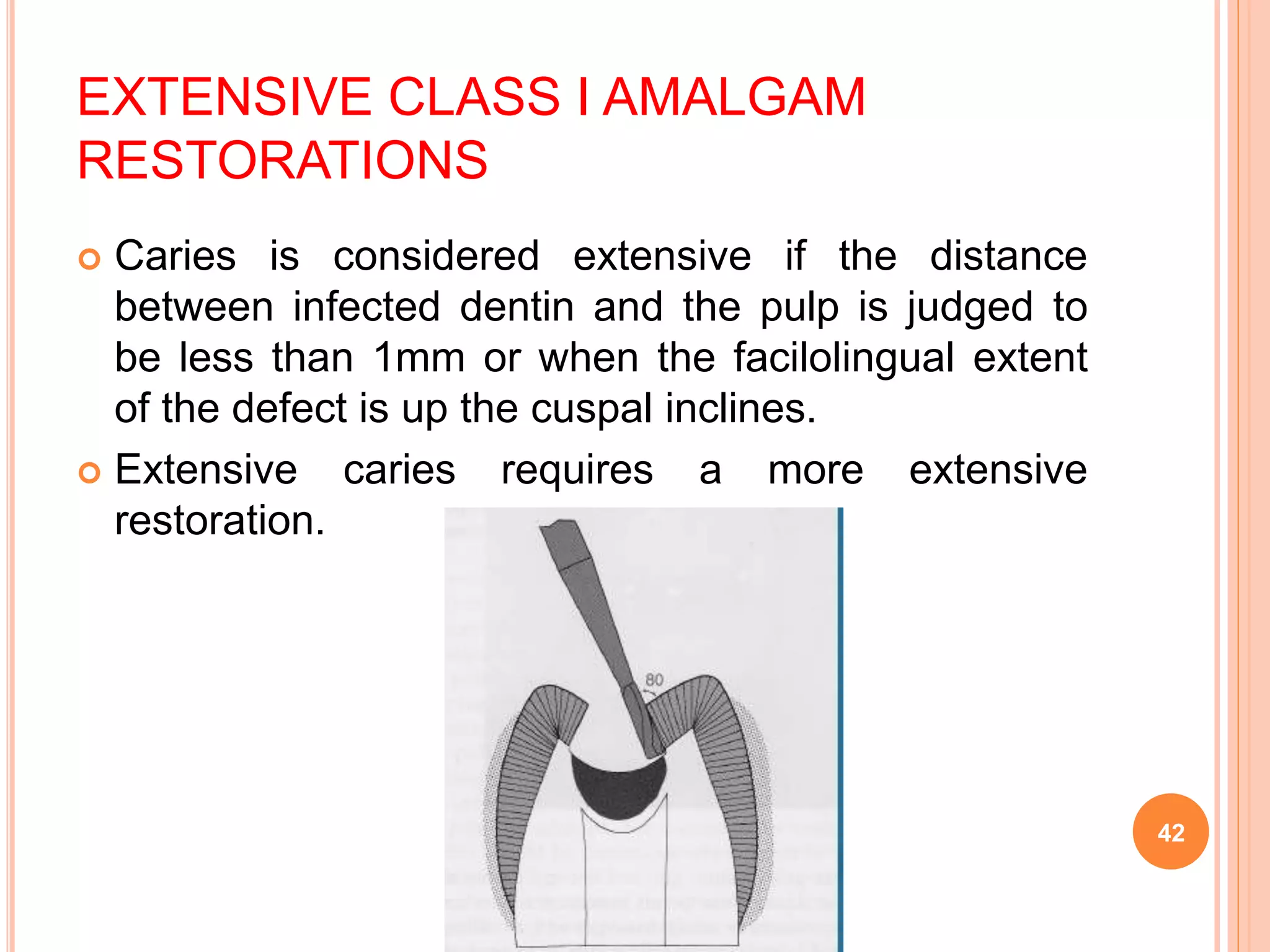 Class i cavity preparation | PPTX
