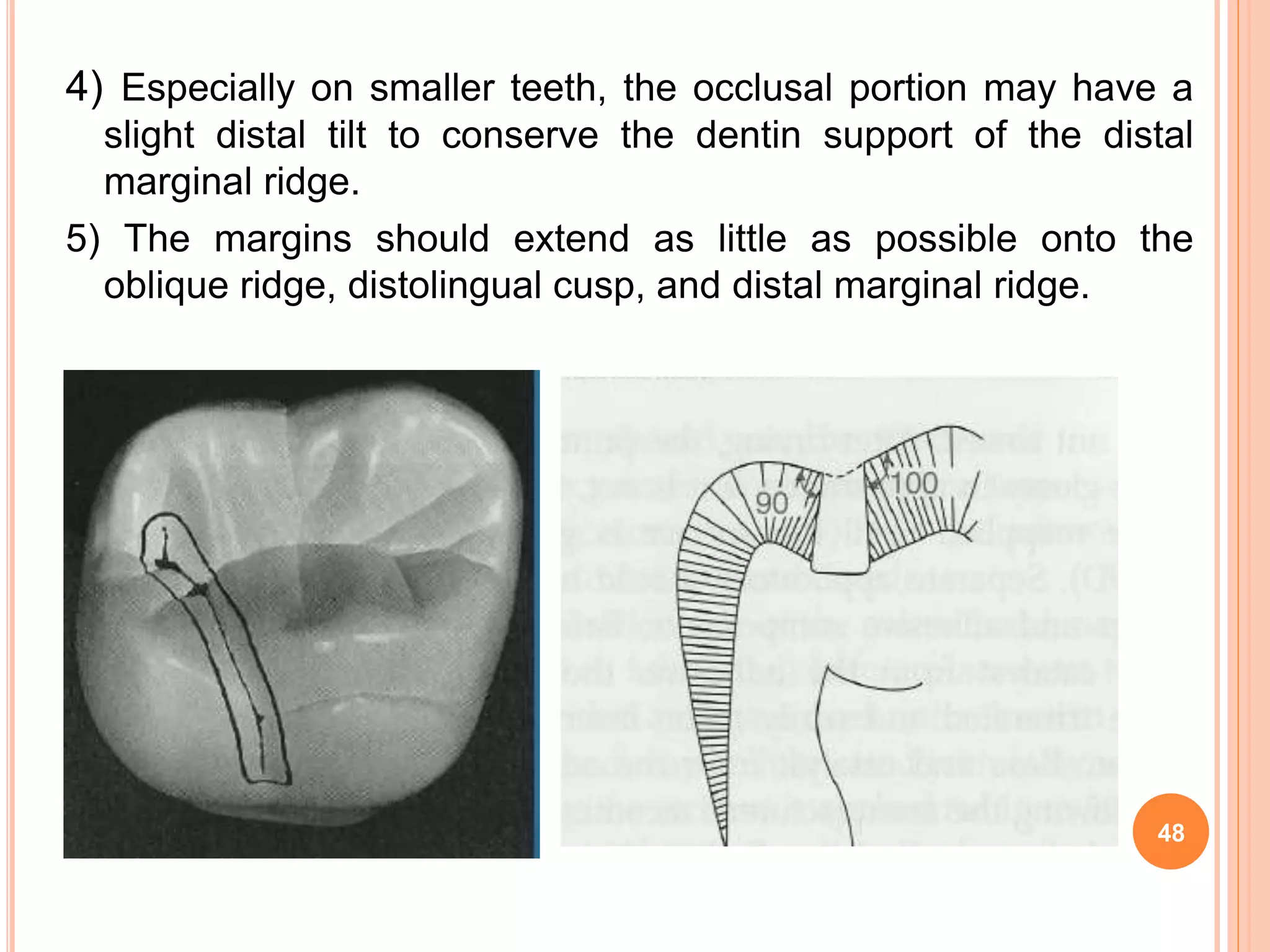 Class i cavity preparation | PPTX