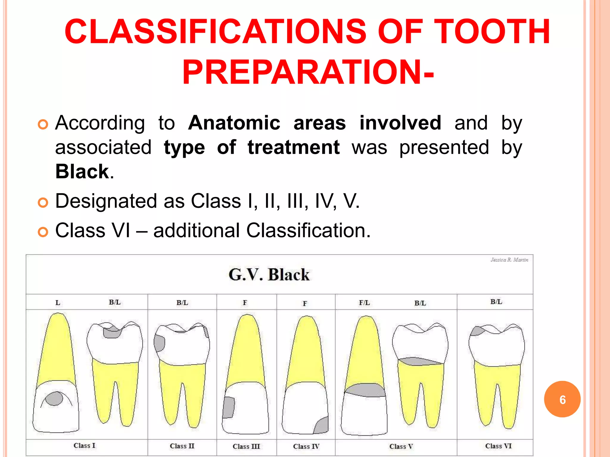Class i cavity preparation | PPTX