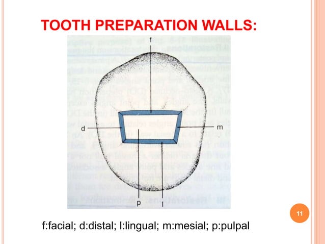Class i cavity preparation | PPTX