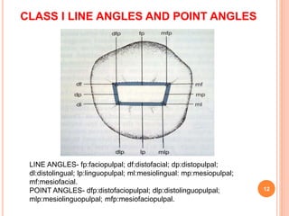 Class i cavity preparation | PPTX