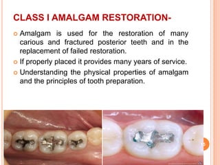 Class i cavity preparation | PPTX