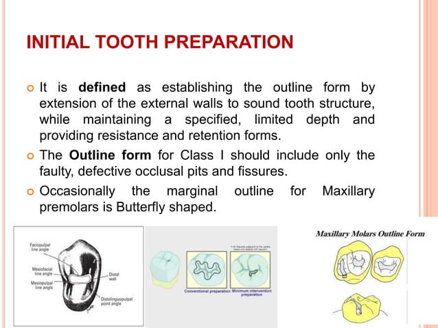 Class i cavity preparation | PPTX