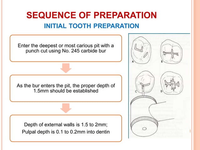 Class i cavity preparation | PPTX