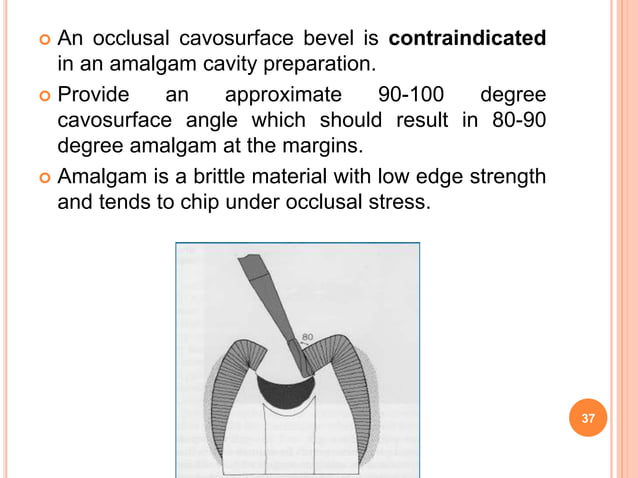 Class i cavity preparation | PPTX