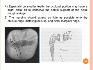 Class i cavity preparation | PPTX