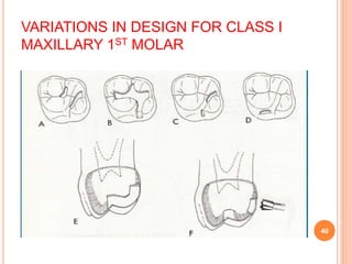 Class i cavity preparation | PPT
