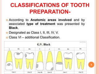 GV Black Classification Of Caries MEDizzy, 49% OFF