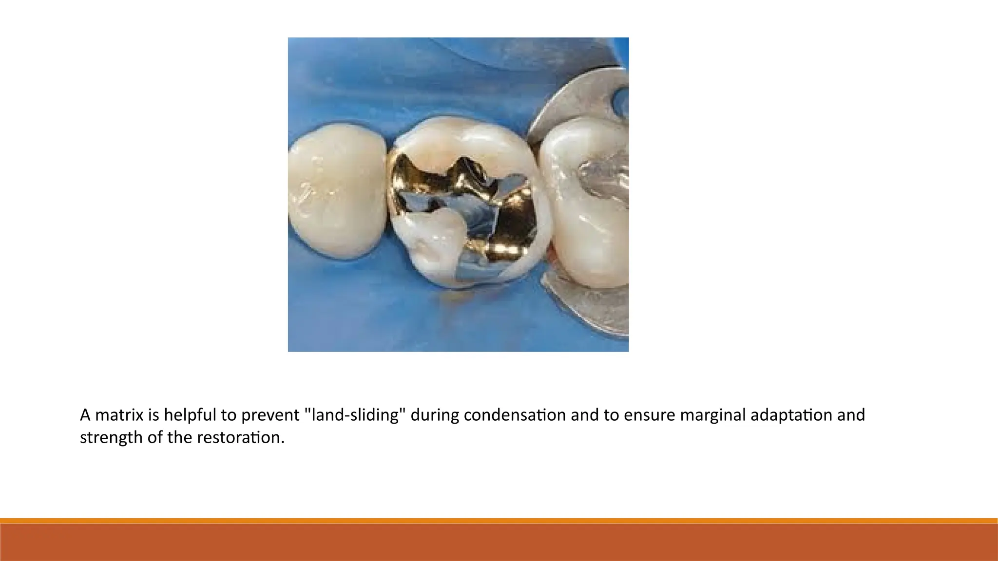 Class I cavity preparation for Amalgam.pptx | Dental Health | Diseases and Conditions
