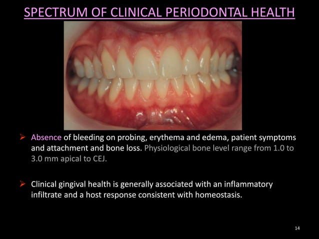 AAP 2017 CLASSIFICATION OF PERIODONTAL DISEASE PART 1