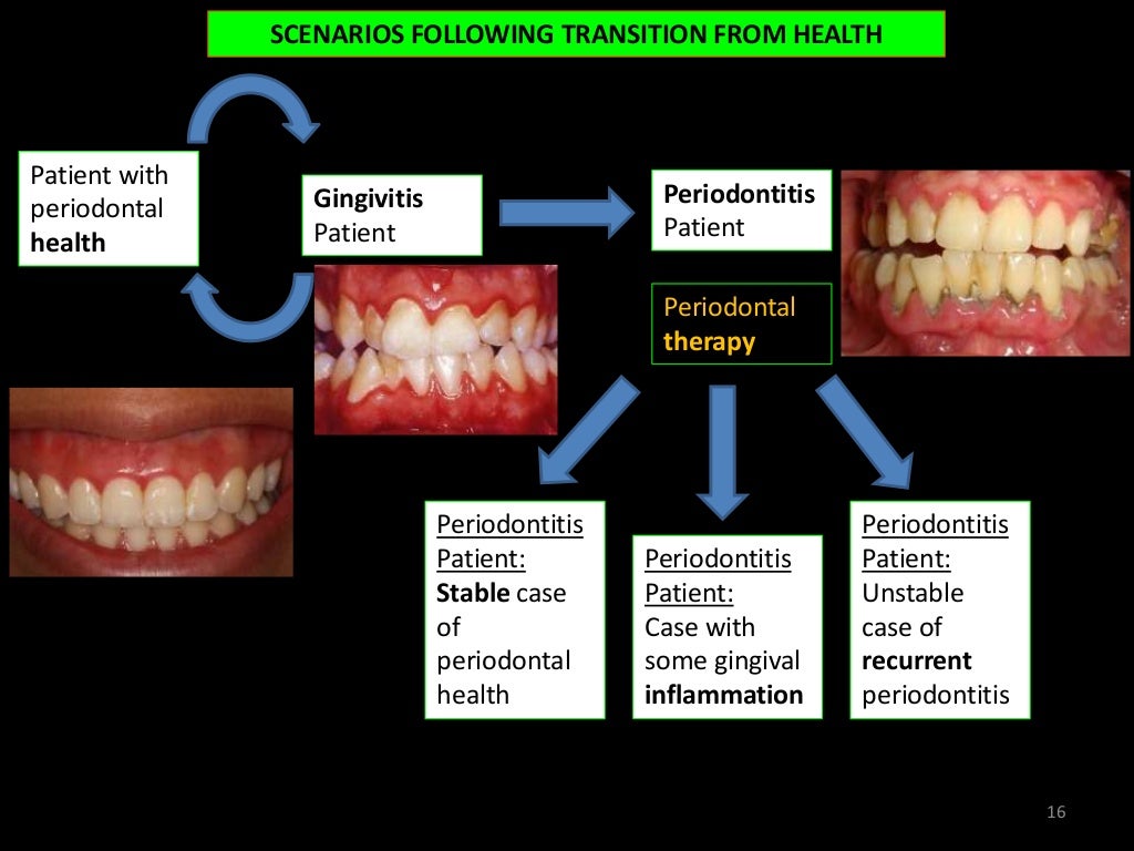 AAP 2017 CLASSIFICATION OF PERIODONTAL DISEASE PART 1