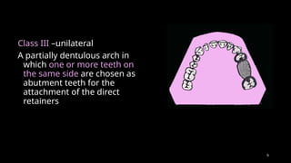 classifctn of RPD .pptx