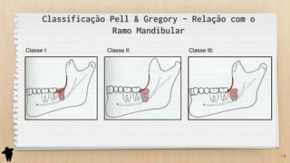 Classificação de Winter e Classificação Pell e Gregory - Cirurgia ...