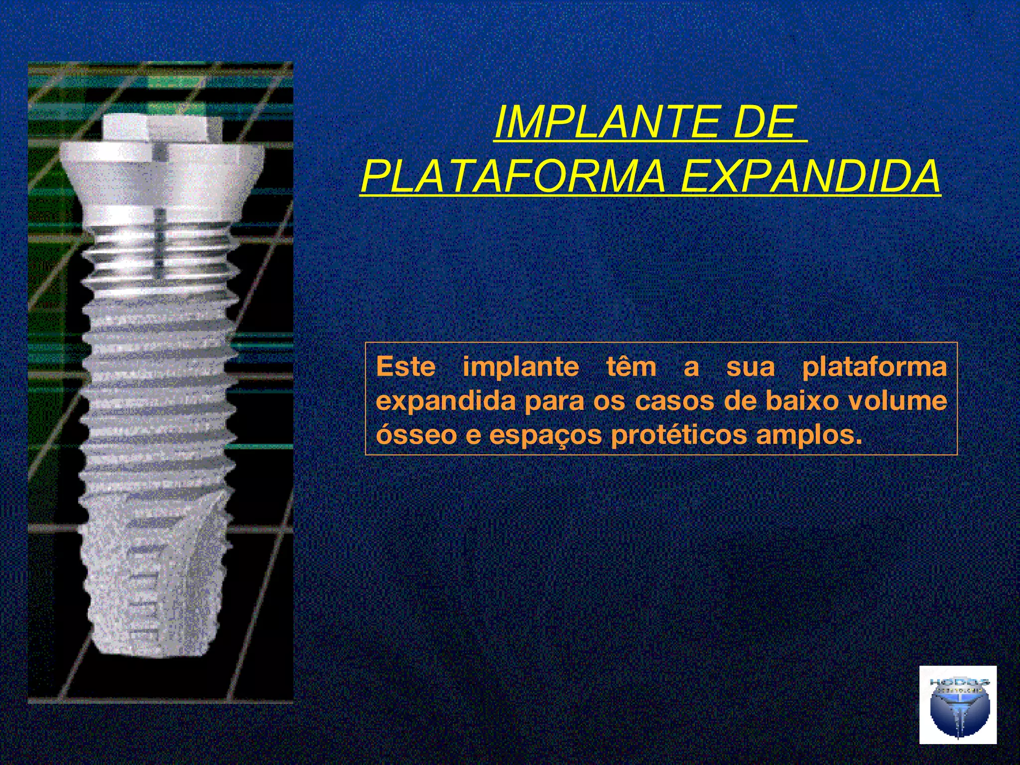 ClassificaçãO E Tipos De Implantes Alunos | PPT | Download Gratuito