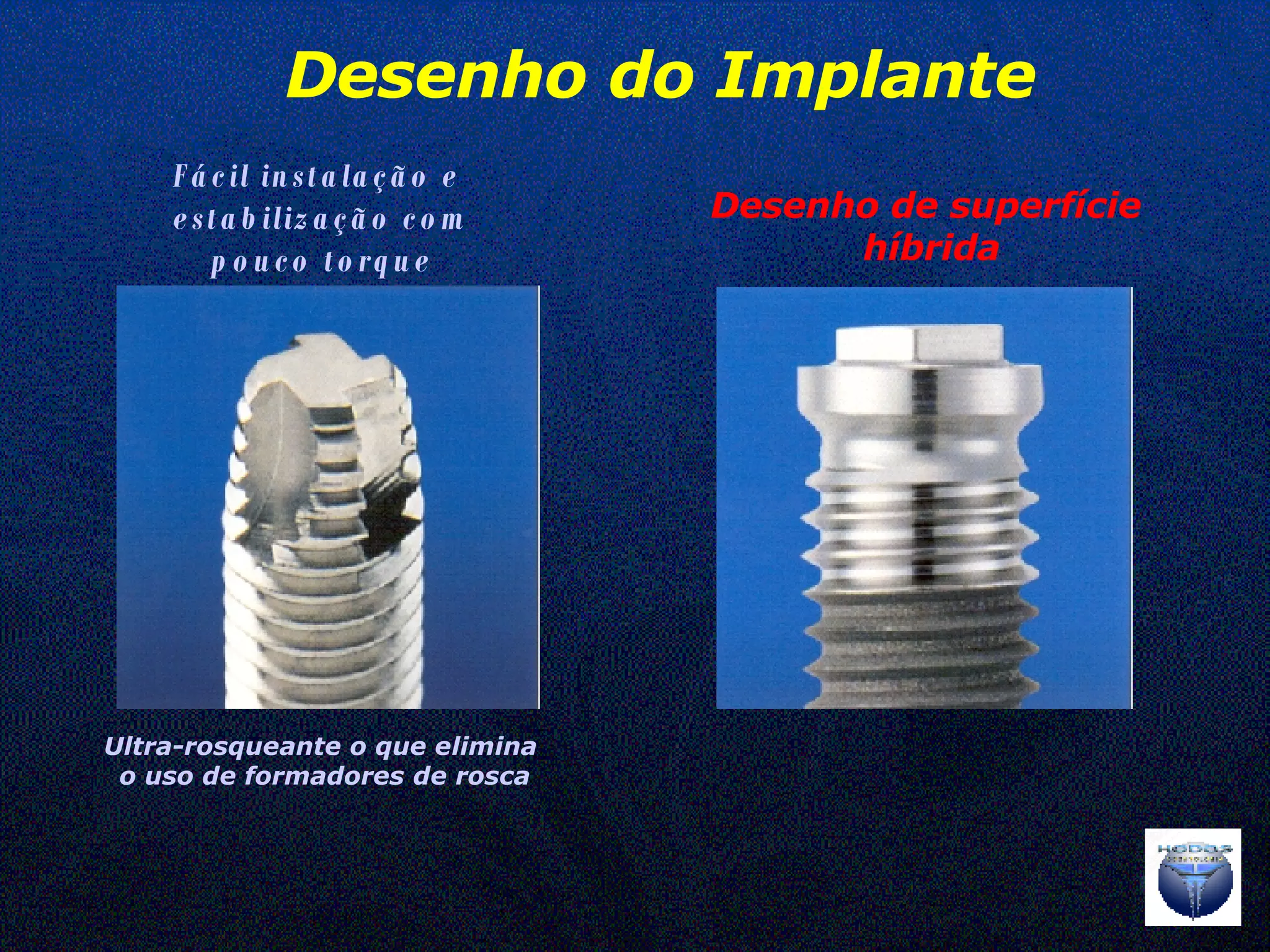 ClassificaçãO E Tipos De Implantes Alunos | PPT