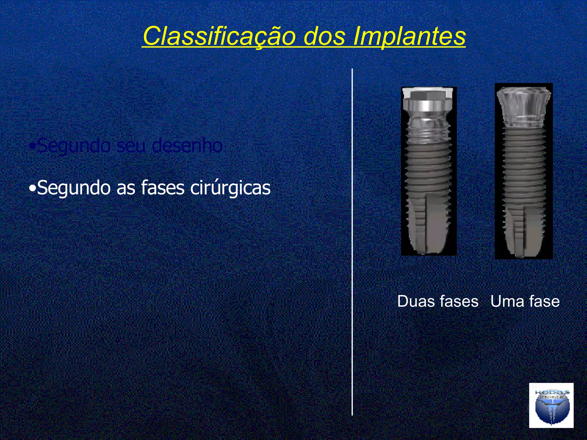 ClassificaçãO E Tipos De Implantes Alunos | PPT