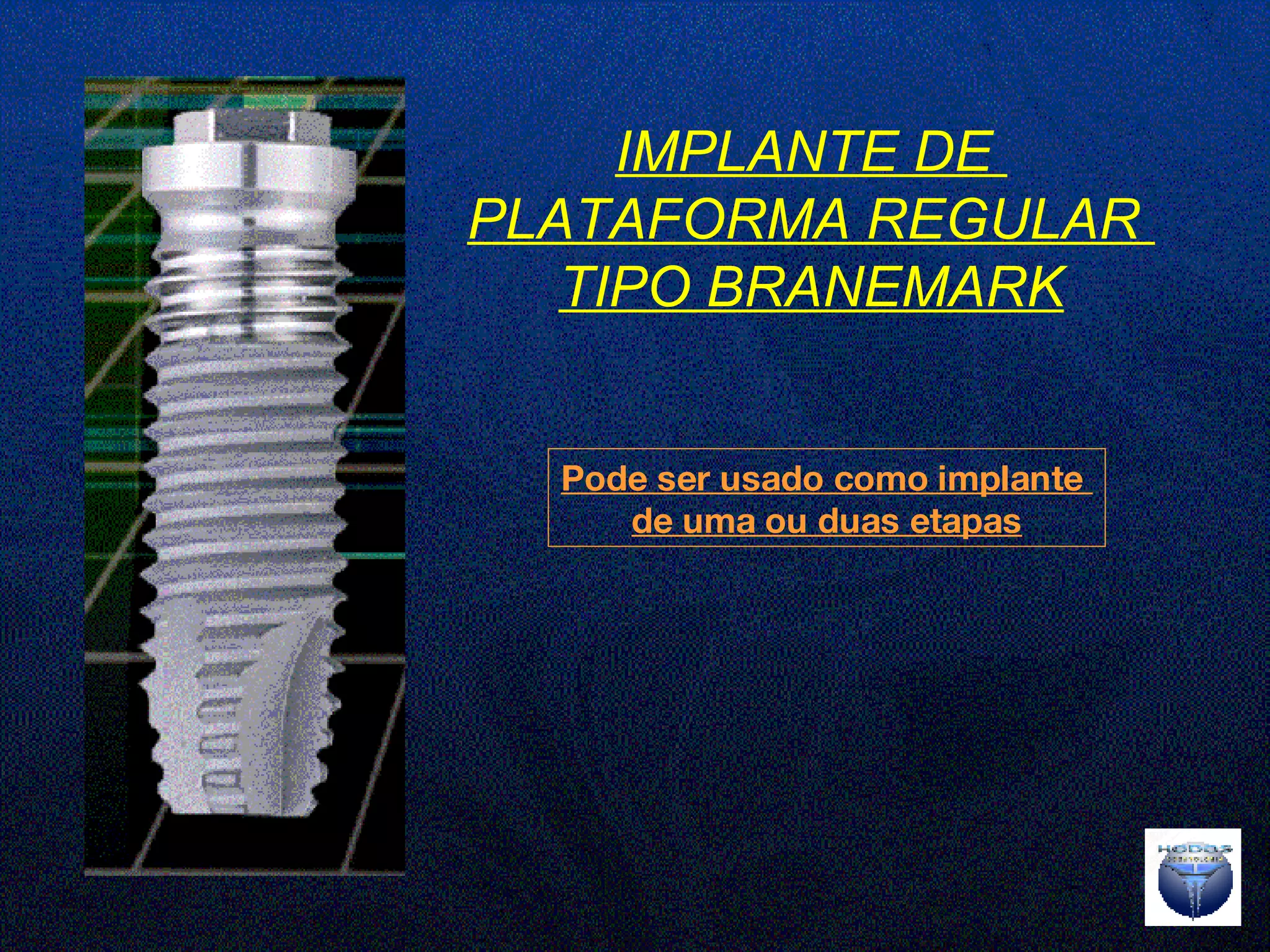 ClassificaçãO E Tipos De Implantes Alunos | PPT
