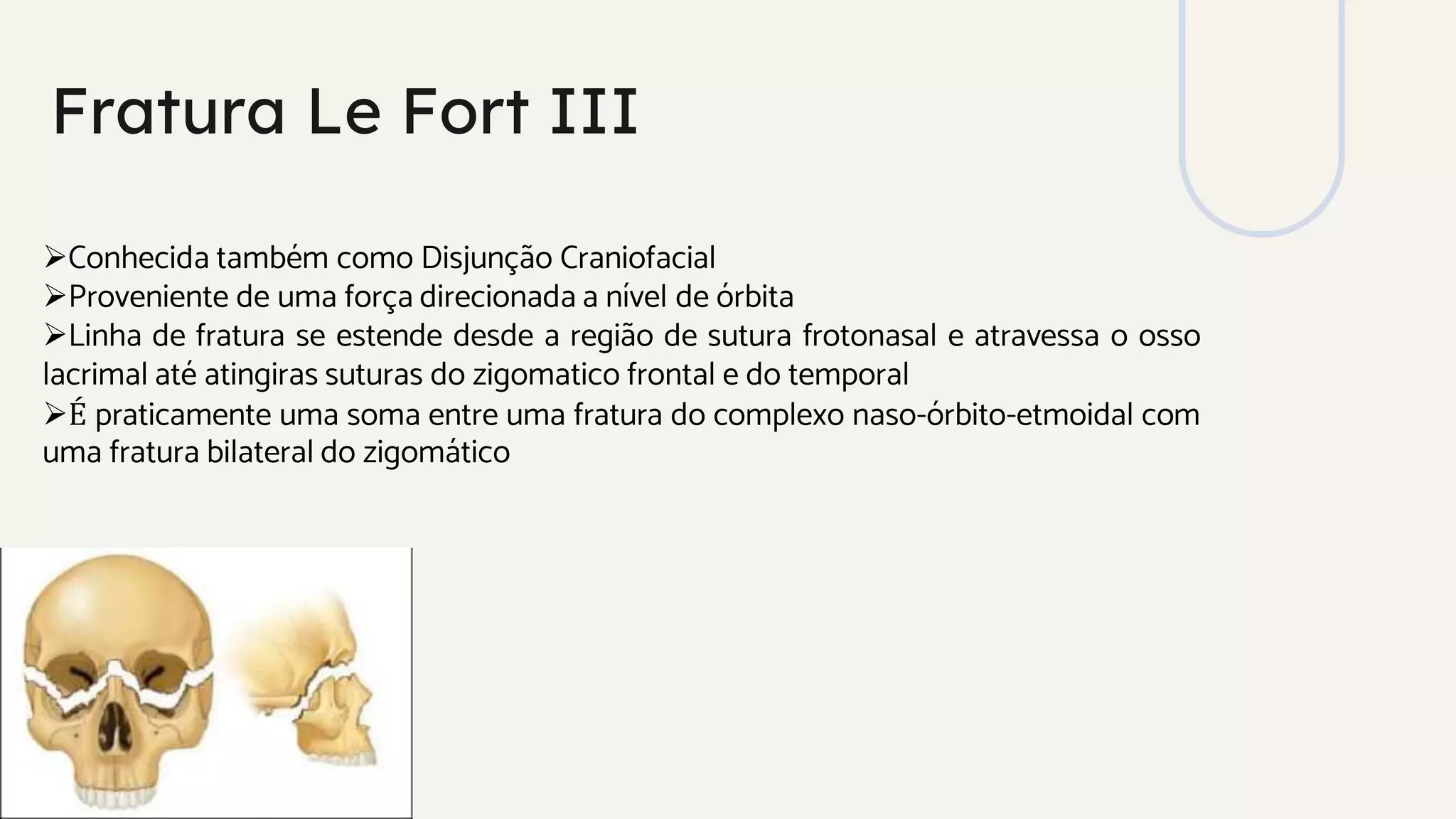 Classificação Le Fort - Concurso Odontologia - Resumo #1.pdf