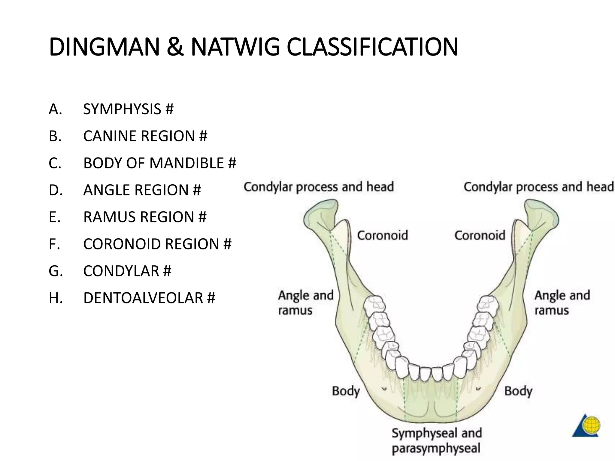 Classification of Mandible, Midface, ZMC and NOE Fractures | PPTX