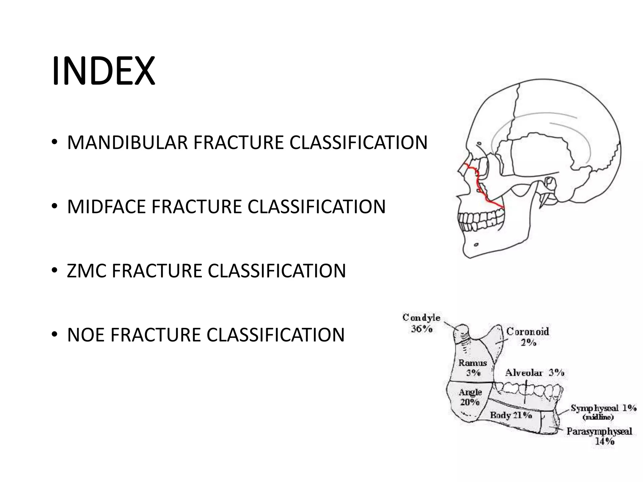 Classification of Mandible, Midface, ZMC and NOE Fractures | PPTX