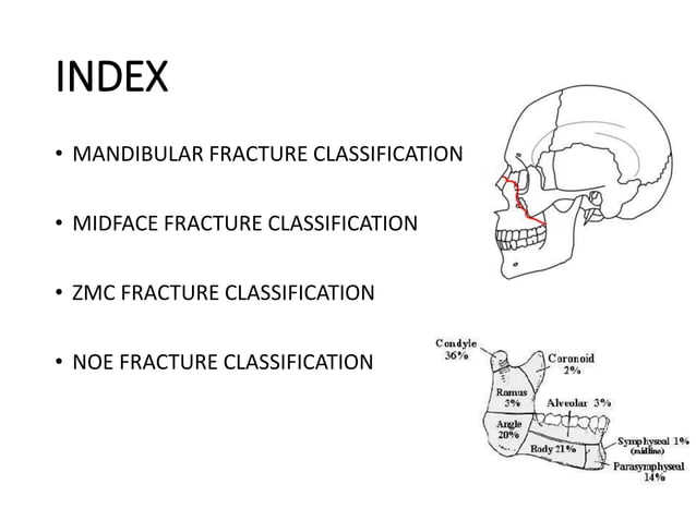 Classification of Mandible, Midface, ZMC and NOE Fractures | PPTX ...