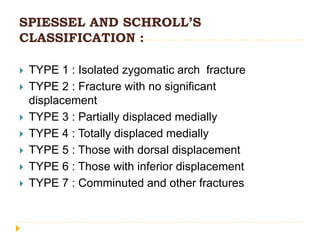 Classification of Mandible, Midface, ZMC and NOE Fractures | PPT