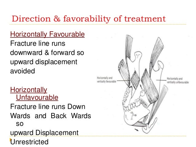 Classification of Mandible, Midface, ZMC and NOE Fractures