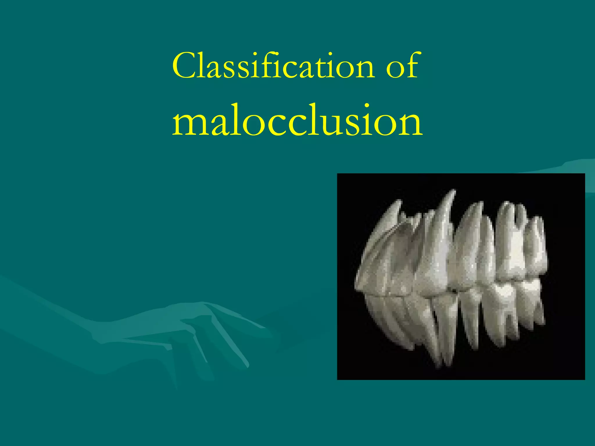 Classification of Malocclusion | PPT