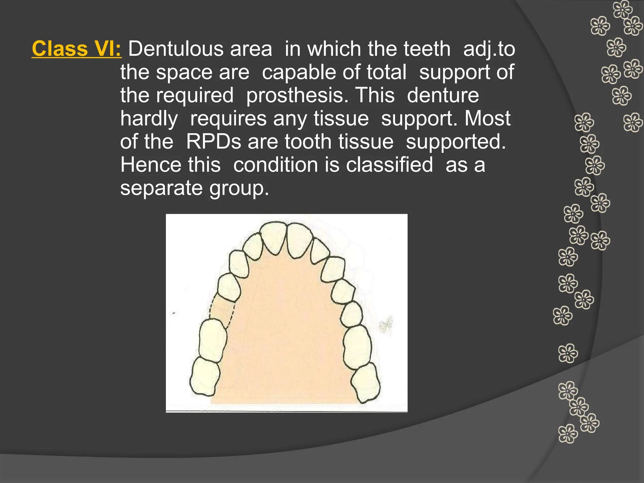 Classification of edentulous arches.pptx