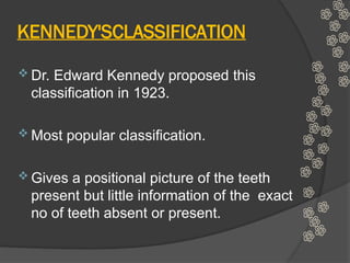 Classification of edentulous arches.pptx