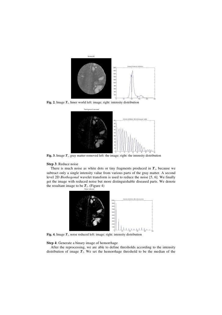 Classification of CT..