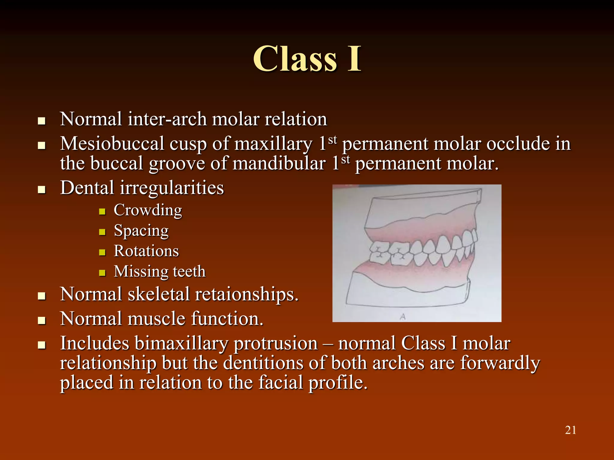 Classification-of-Malocclusion O.ppt