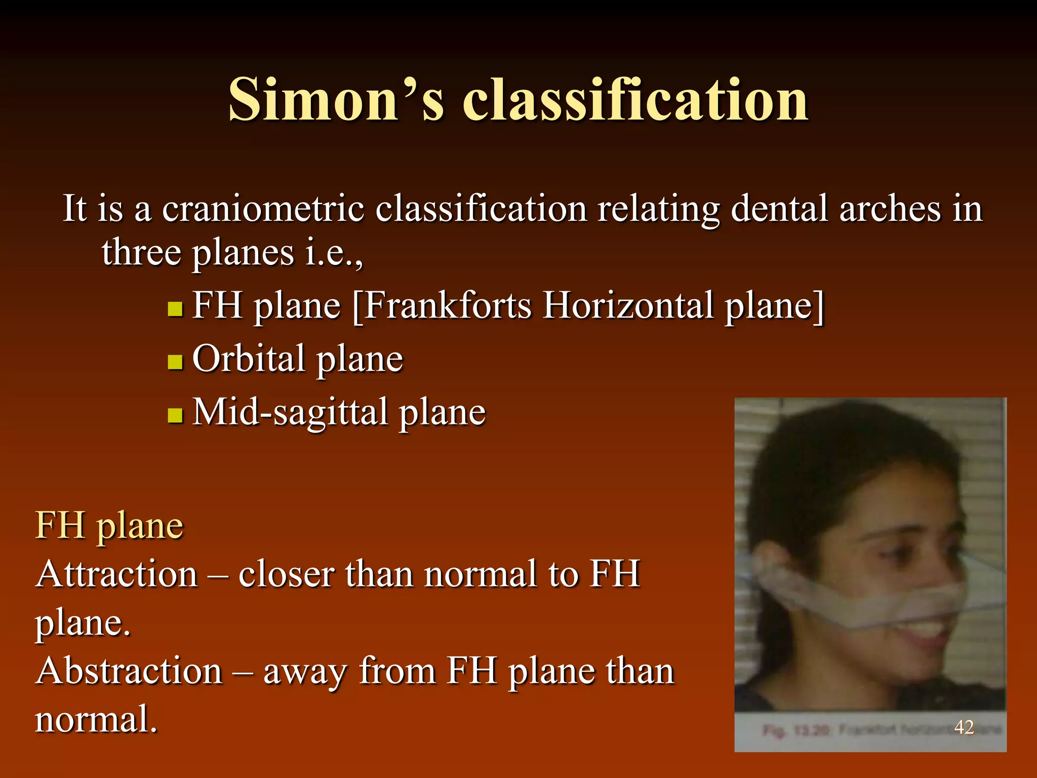 Classification-of-Malocclusion O.ppt
