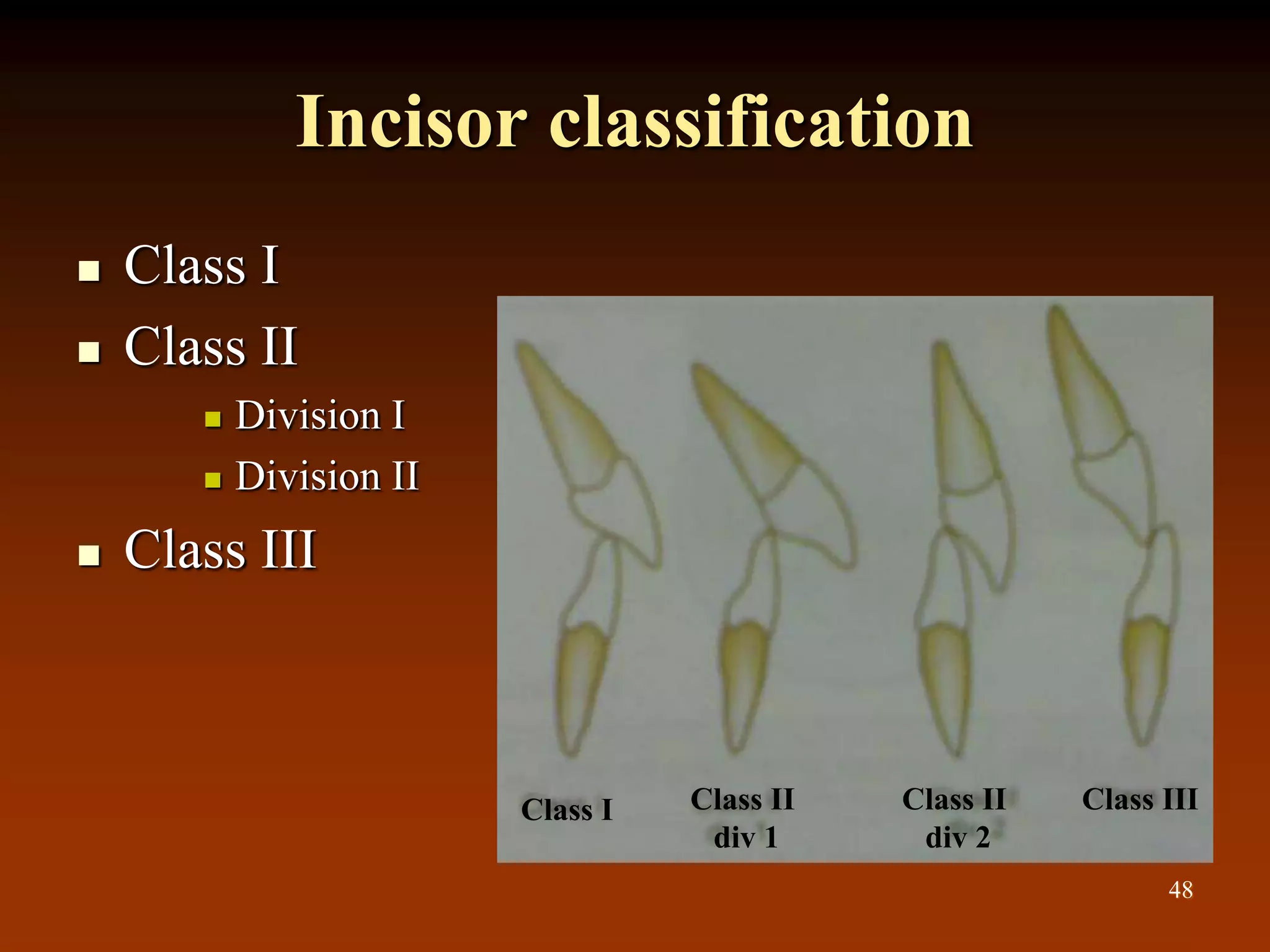 Classification-of-Malocclusion O.ppt