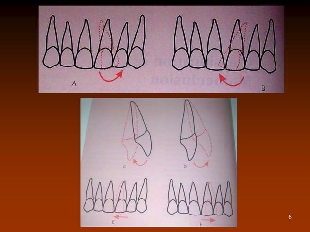 Classification-of-Malocclusion O.ppt