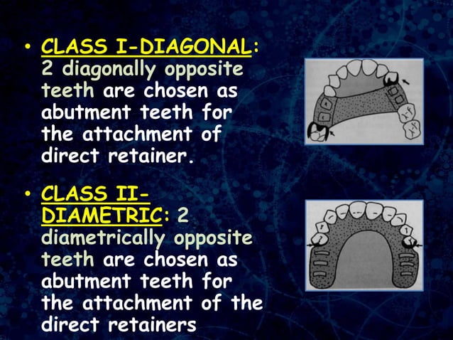Classification of Partially Edentulous Arches | PPTX