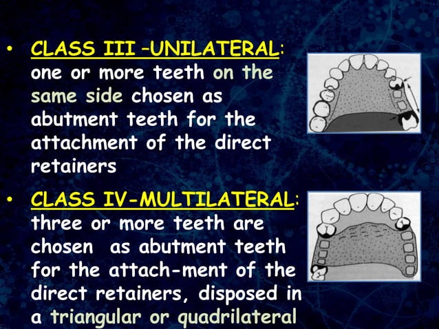 Classification of Partially Edentulous Arches | PPTX