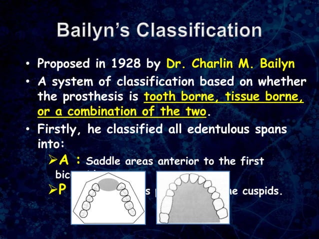 Classification of Partially Edentulous Arches | PPTX
