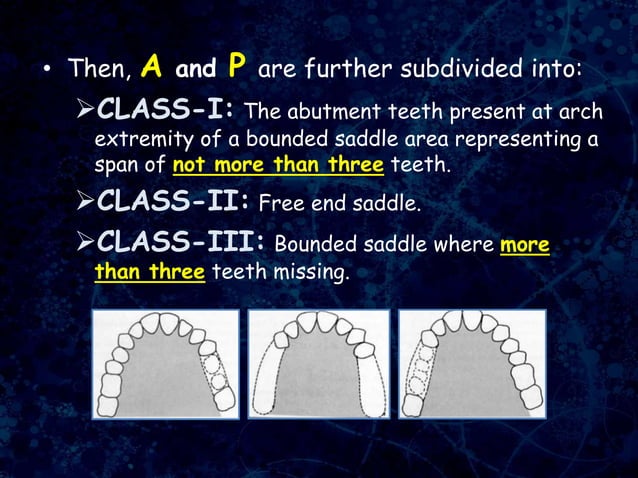 Classification of Partially Edentulous Arches | PPTX