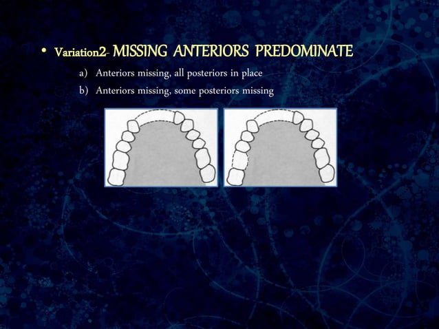 Classification of Partially Edentulous Arches | PPTX