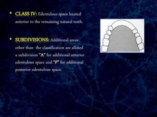Classification of Partially Edentulous Arches | PPTX