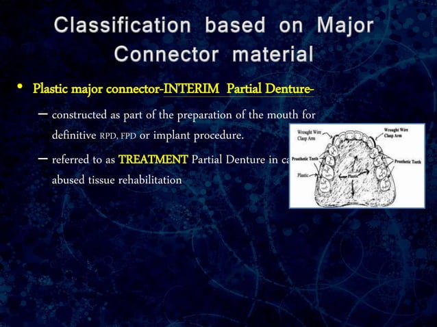 Classification of Partially Edentulous Arches | PPTX