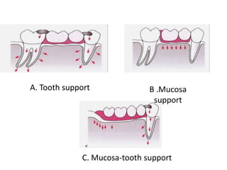 classification (1).pptx | Dental Health | Diseases and Conditions