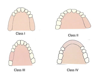 classification (1).pptx