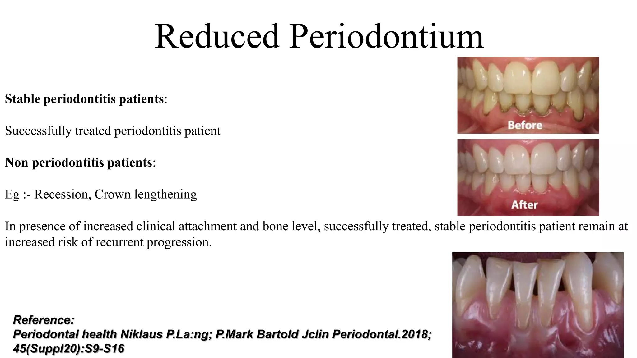 Classification 2017 part 1 | PPTX