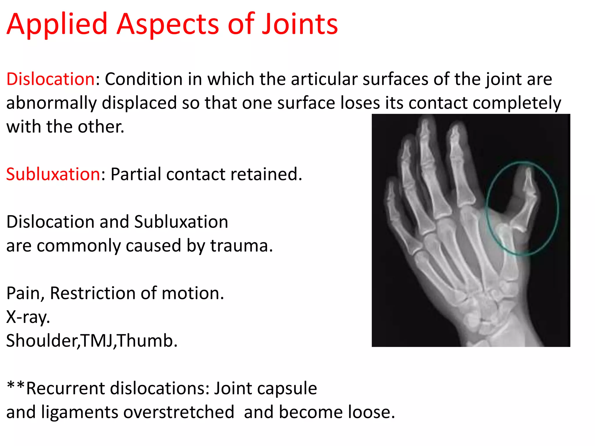 Classification and applied aspects of joints | PPTX
