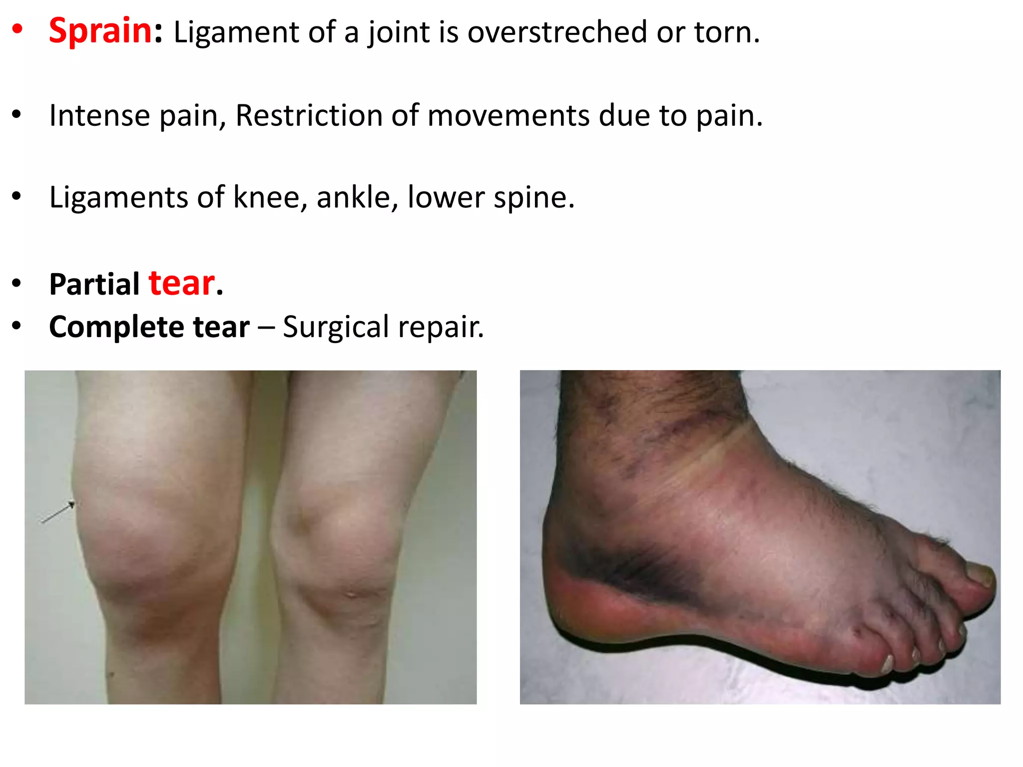 Classification and applied aspects of joints | PPTX