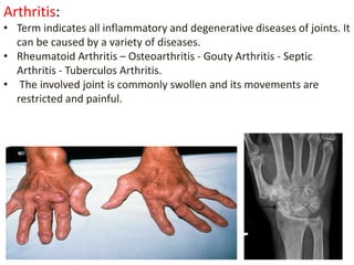 Classification and applied aspects of joints | PPTX
