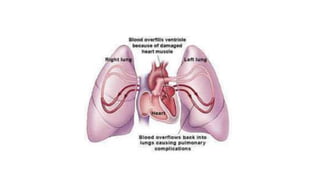 Classification and clinical features of congestive heart failure | PPTX